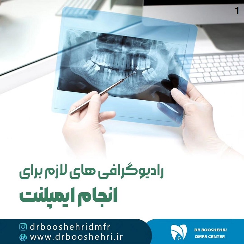 مرکز عکس cbct دندان | نوبت دهی آنلاین | رادیولوژی دندان دکتر بوشهری