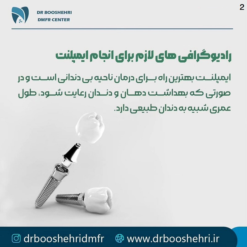 مرکز عکس cbct دندان | نوبت دهی آنلاین | رادیولوژی دندان دکتر بوشهری