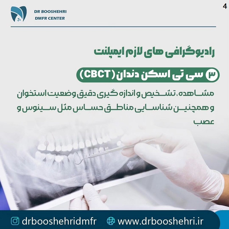 مرکز عکس cbct دندان | نوبت دهی آنلاین | رادیولوژی دندان دکتر بوشهری