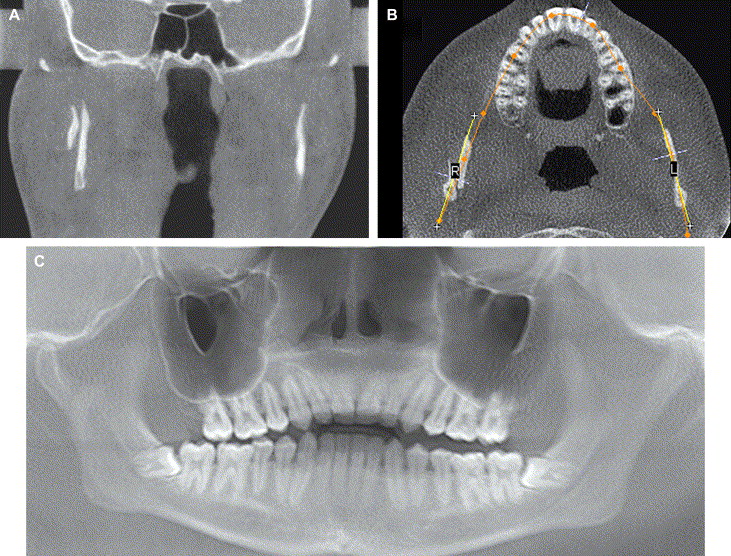 Maxillofacial Radiology | 5 Treatment Methods Oral Diseases