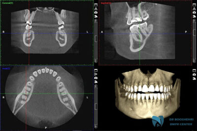 Difference between CBCT and CT | 5 Practical Advantages